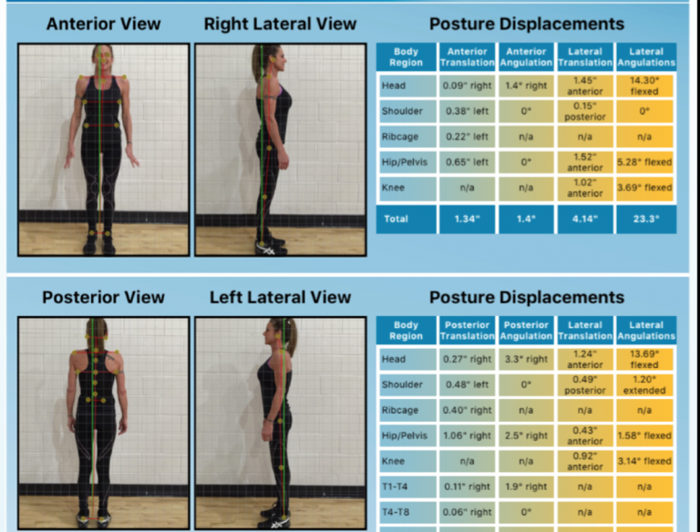 3D Postural Assessments - Chiropractor in Marana | Chiropractor in Tucson